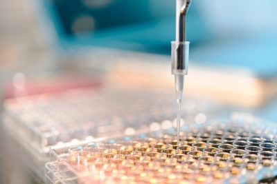 Mengenal ELISA: Prinsip, Jenis, dan Aplikasinya - AVIDA Bioscience